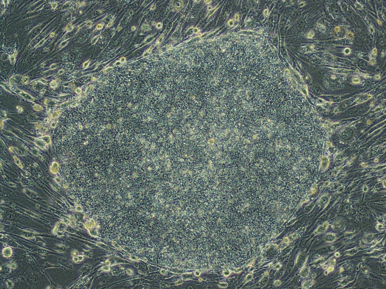 iPS cells derived from ALS patient | Research Overview | Haruhisa Inoue ...